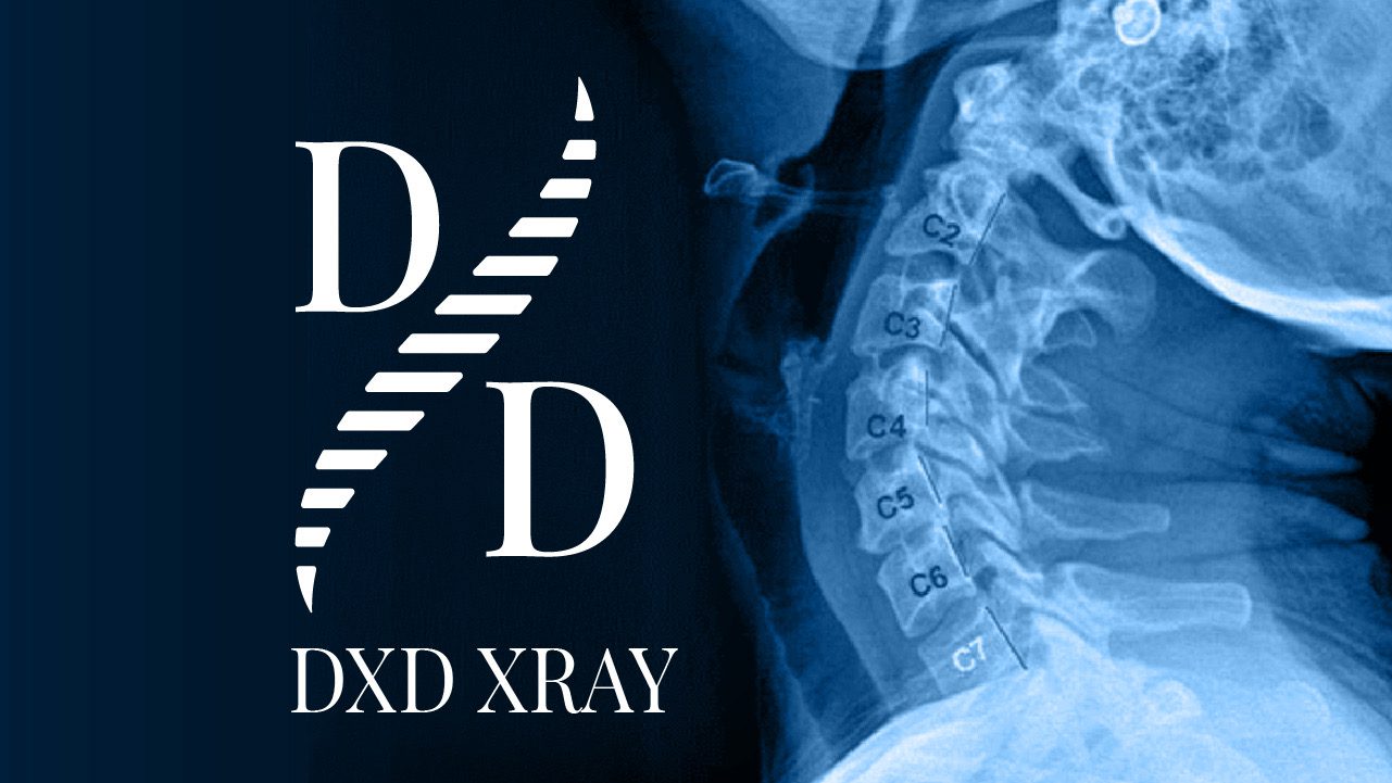 Home - DXD Xray
